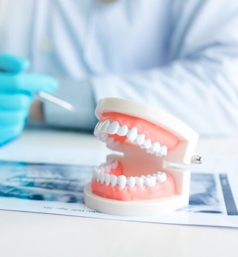 Dentures - Dr. Dove Dental Office